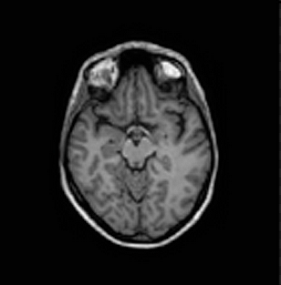 Pseudo CT Synthesis - Medimsight